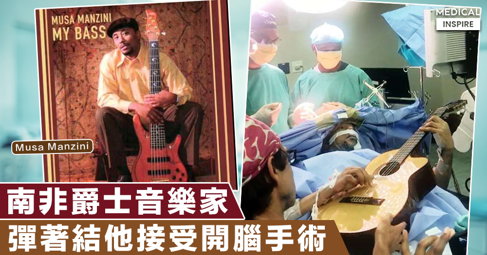 【勇氣可嘉】南非爵士音樂家Musa Manzini勇於面對恐懼，彈著結他接受開腦手術。 – Medical Inspire 醫・思維
