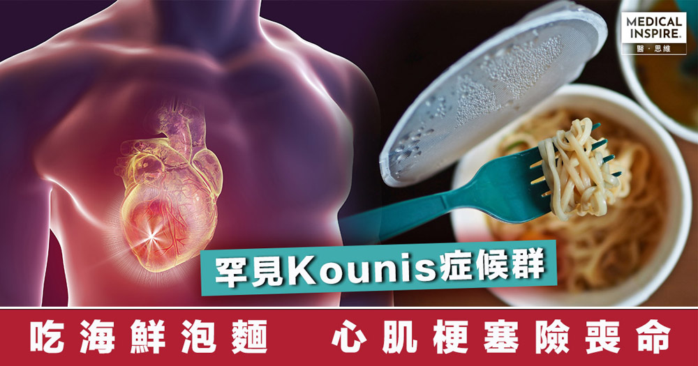 罕見Kounis 症候群 吃海鮮泡麵險喪命 – Medical Inspire 醫・思維
