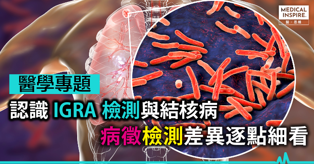 【醫療專題】認識 IGRA檢測與結核病 病徵檢測差異逐點細看 – Medical Inspire 醫・思維