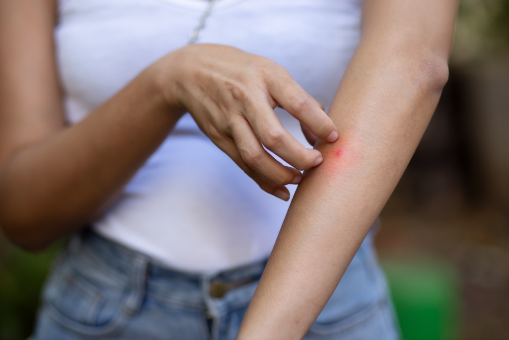 Asian,Woman,Scratching,Her,Arm,Skin,,Health,Care,Concept,Image ...